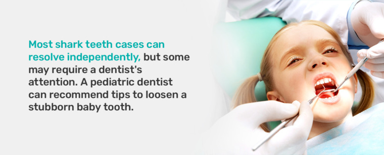Shark Teeth | Why Your Child May Have Two Rows Of Teeth